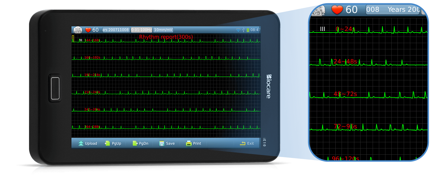 Point-of-Care 12-Lead ECG/EKG Machine Based on A Tablet, with Auto ...